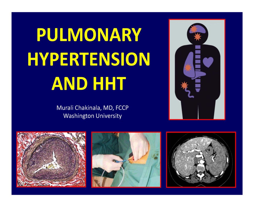 Pulmonary Hypertension and HHT (recorded) - CureHHT