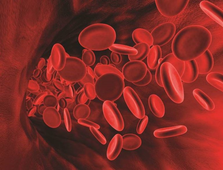 Low Iron Levels and Blood Clots in HHT - CureHHT