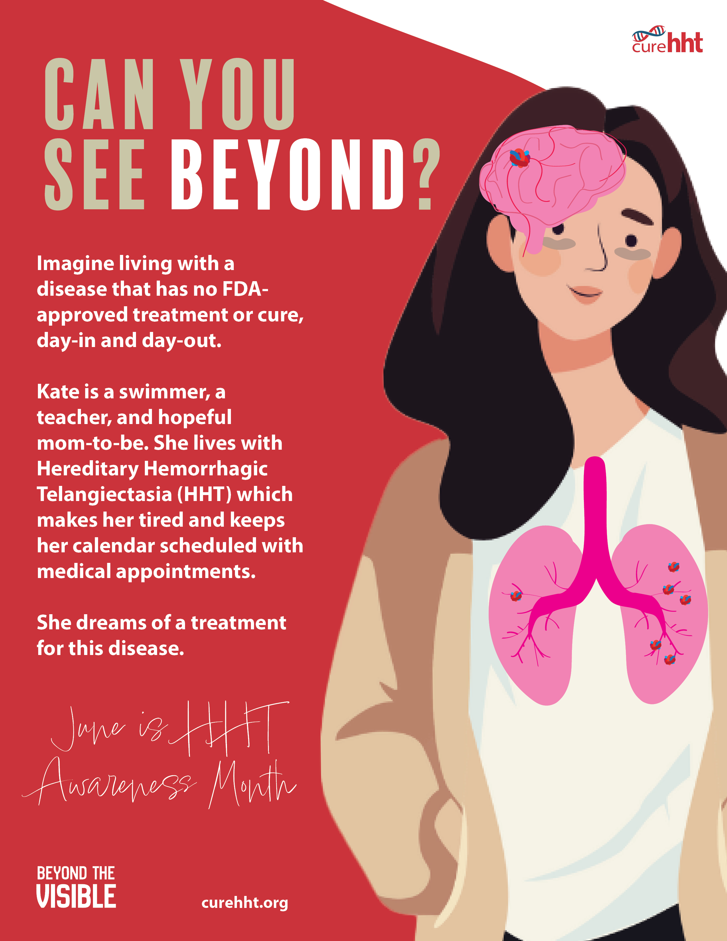 Awareness25_Posters1 - CureHHT